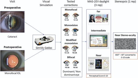 Visual simulations of presbyopic corrections through cataract ...